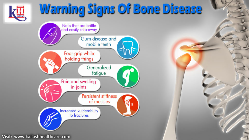 Warning Signs Of Bone Disease Warning Signs Of Bone Disease