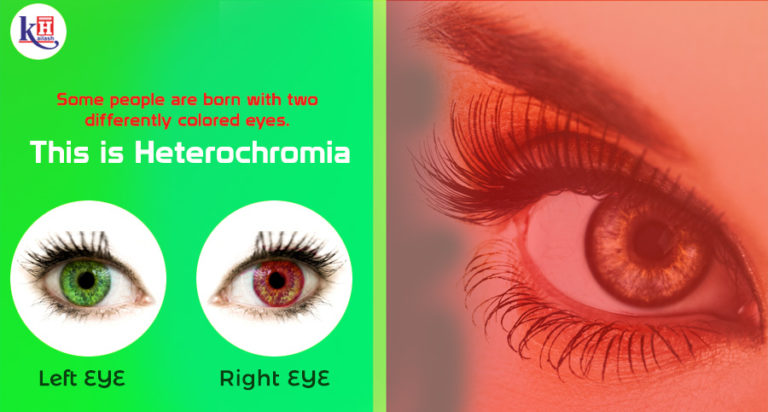 What is Heterochromia