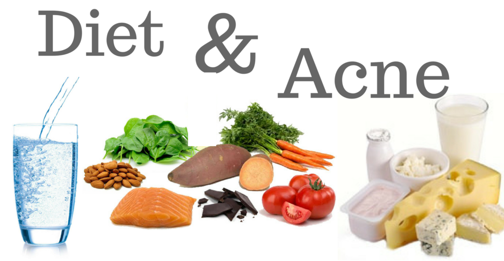 Acne: Acne Causes, Acne Types, Acne Treatment and Tips