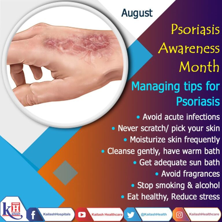 Psoriasis is manageable & treatable if diagnosed early. Know the tips ...