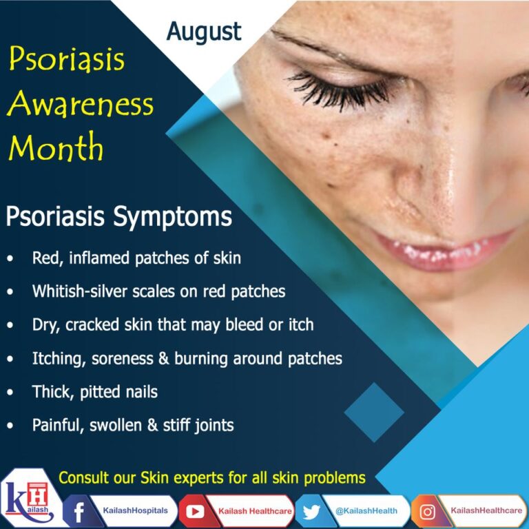 Worsening skin itchiness or scaling may not be normal every time, it ...