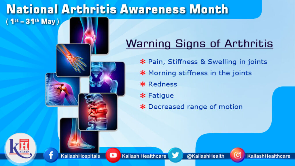 5 Warning Signs That Point to Arthritis