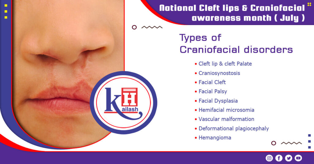 Craniofacial anomalies account for approximately one-third of all birth ...