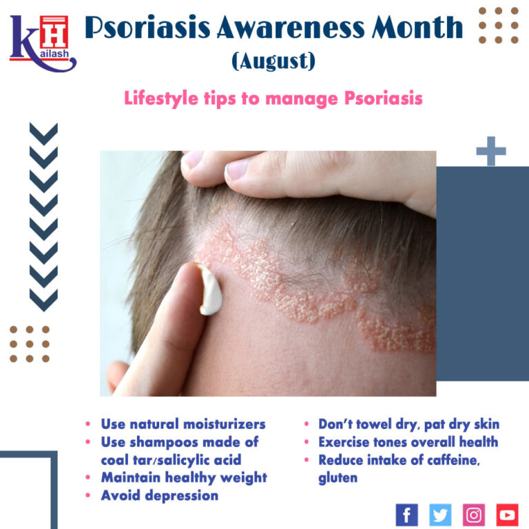Some Healthy Lifestyle tips can help manage Psoriasis & its complications.